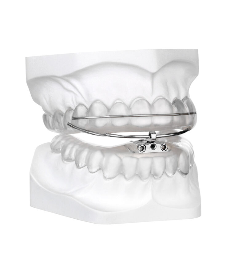 3.2 dreamTAP®-Technik – SCHEU ACADEMY